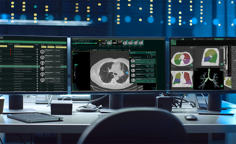 Radiology PACS System | Image Quality by Fujifilm Healthcare